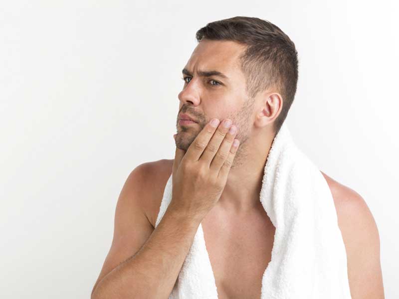 Bald Spots in the Beard: Causes, Signs & Top Treatments